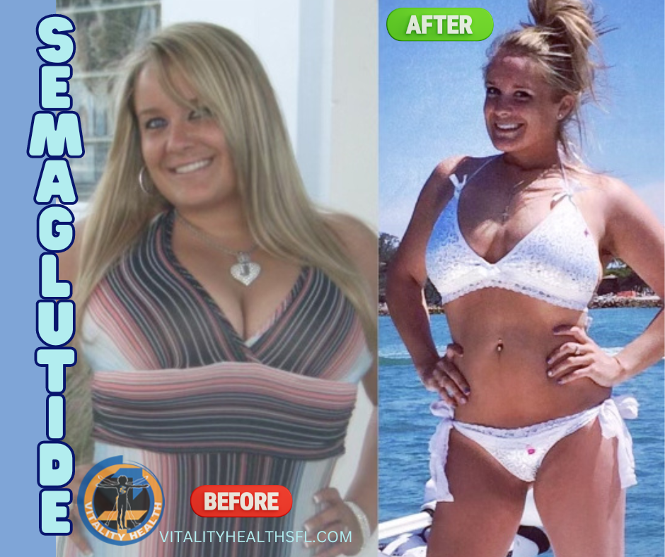 A Better Weight Loss Program Than Using Semaglutide Alone Vitality Sfl
